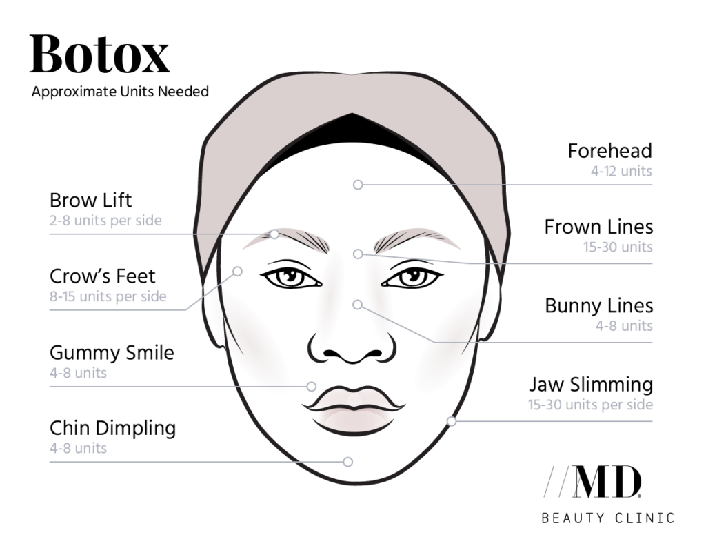 Wrinkle Treatments That Won’t Cost a Fortune | MD Beauty Clinic