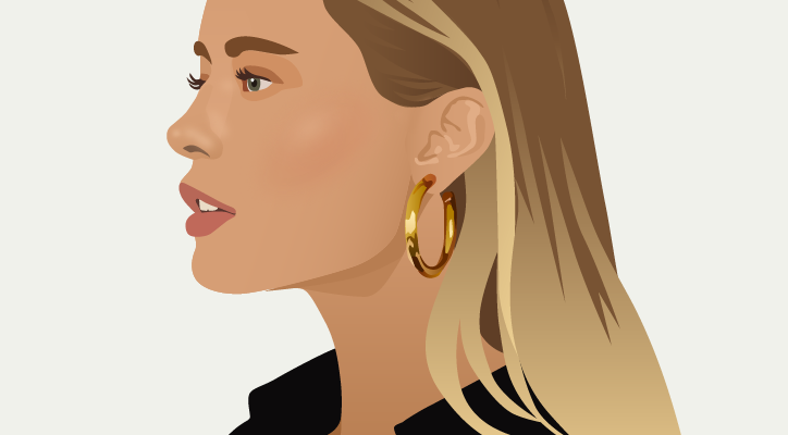 What It's Really Like to Get a Morpheus8 Treatment | MD Beauty Clinic